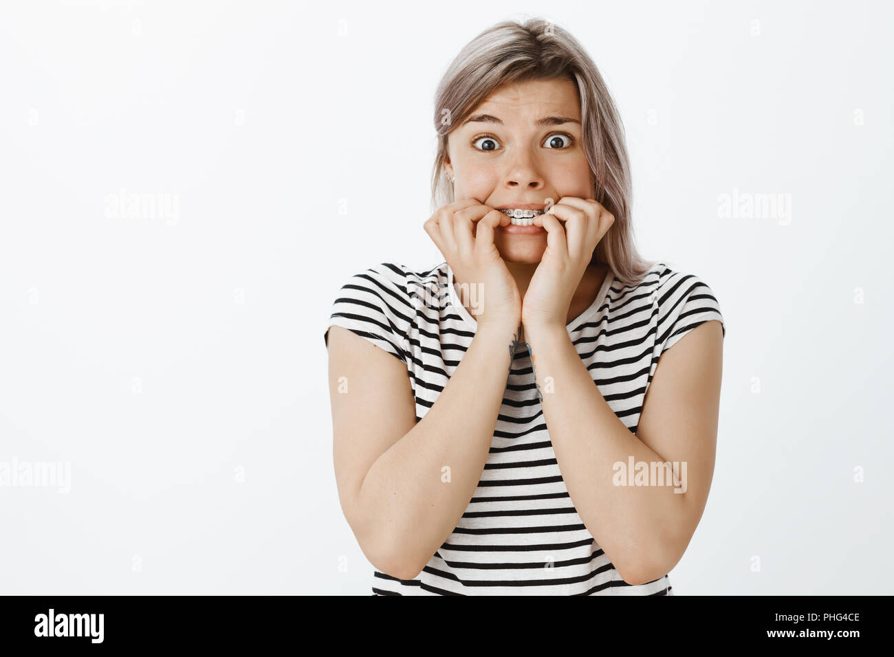 Portrait Of Scared Cute Insecure Woman With Blond Hair And Braces