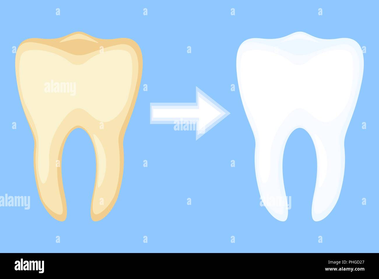Teeth whitening concept before and after Stock Vector Image & Art - Alamy