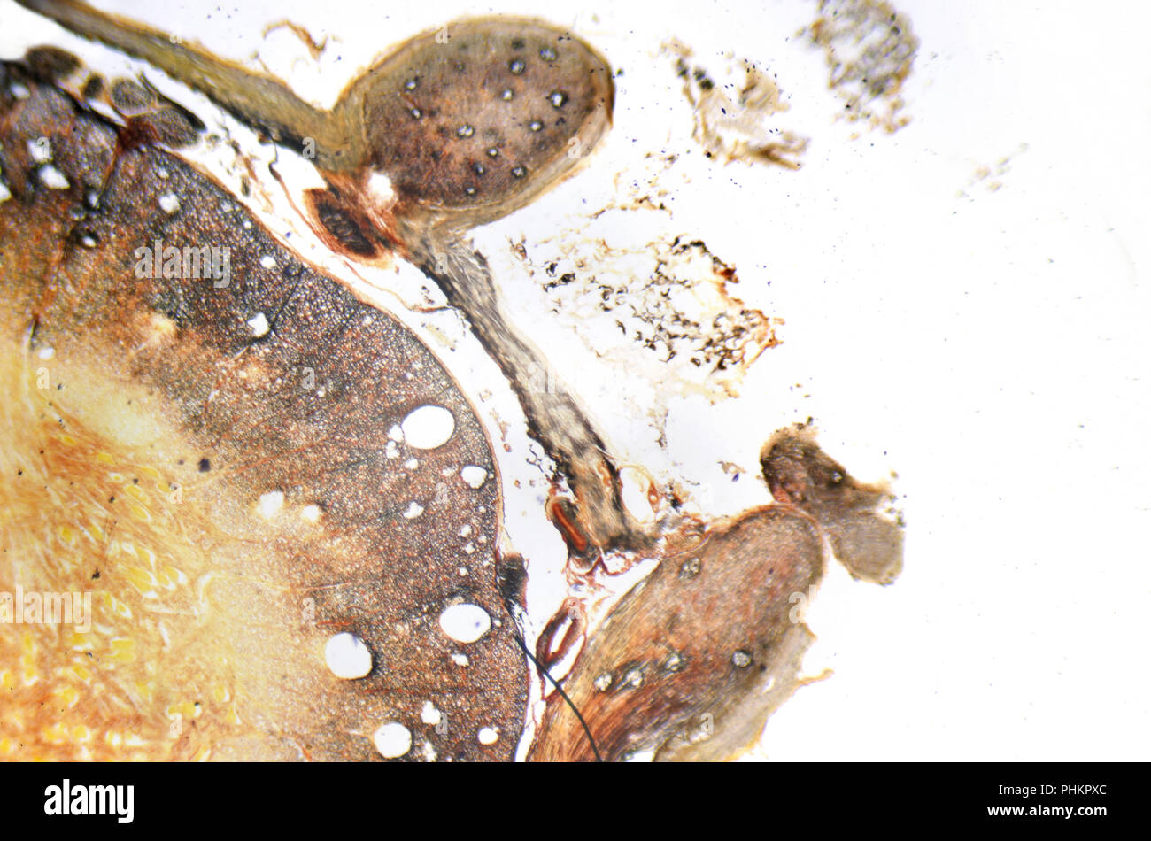 Microscope photography. Spinal cord, cross section Stock Photo - Alamy