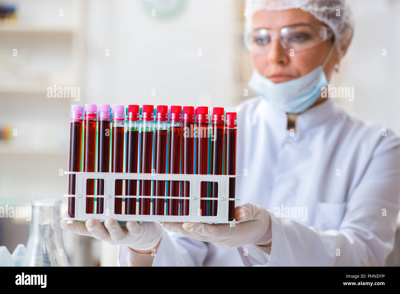 Blood samples in blood collection hi-res stock photography and images ...