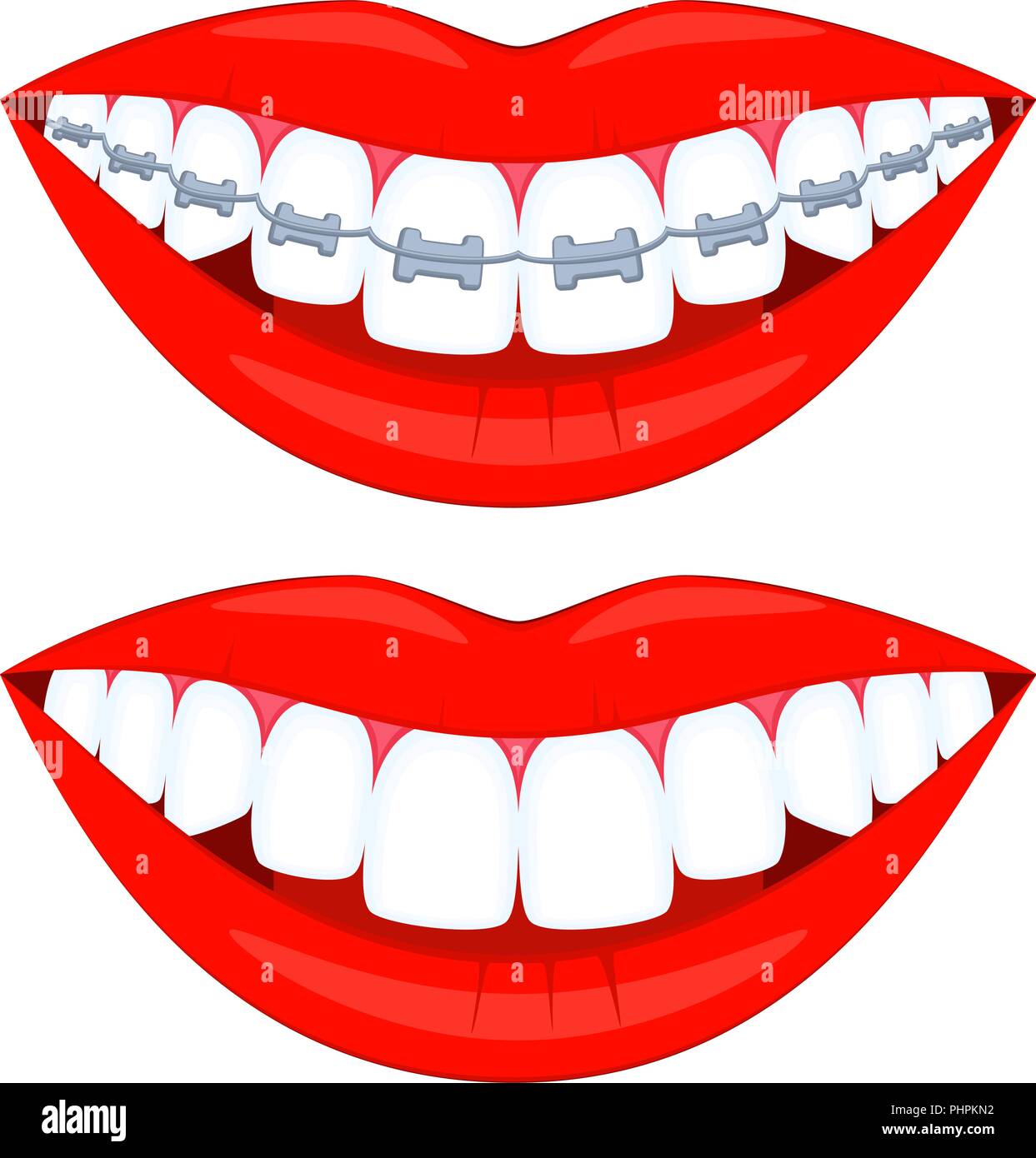 Colorful cartoon teeth aligning elements set Stock Vector Image & Art ...