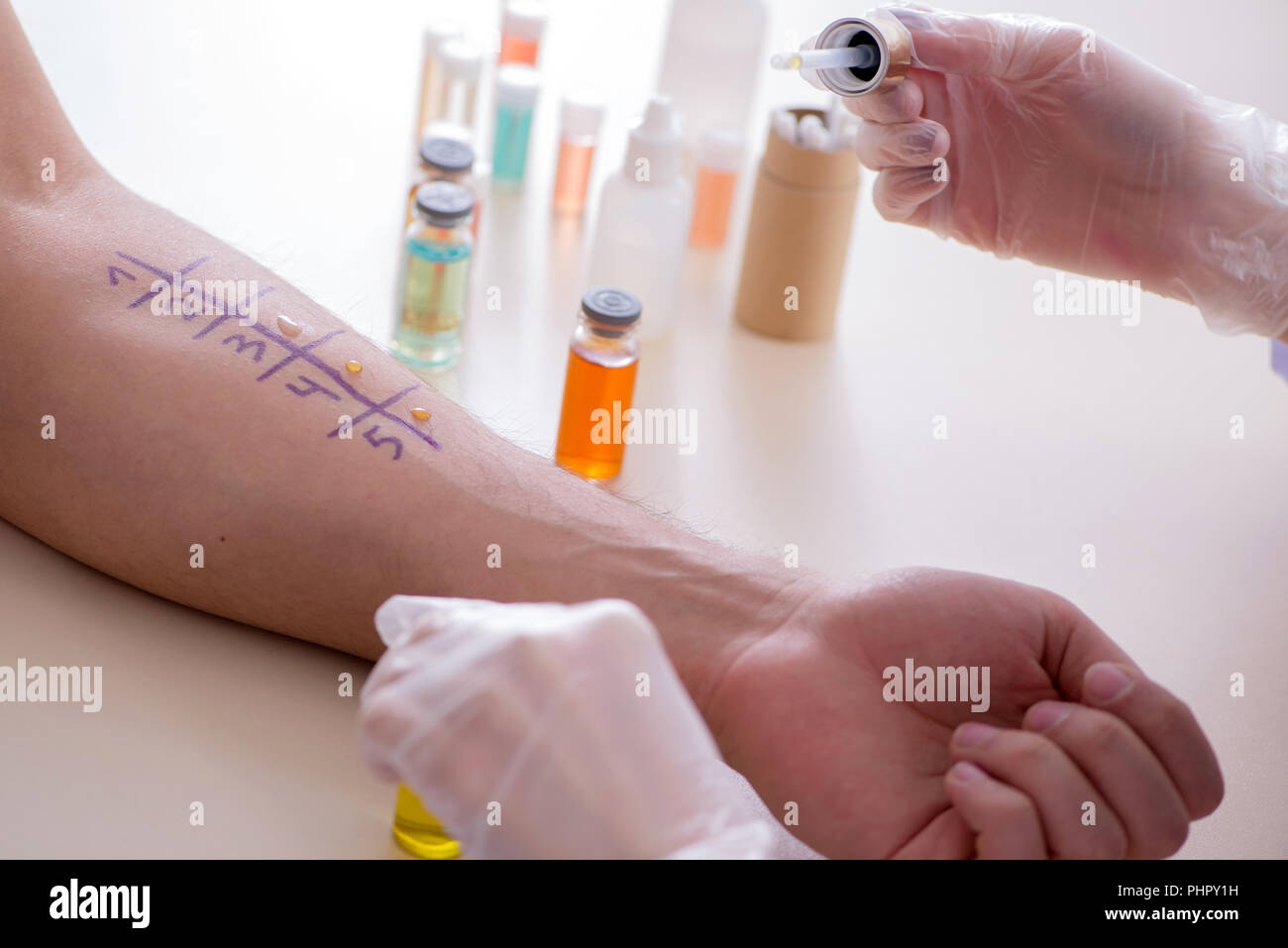 Doctor testing allergy reaction of patient in hospital Stock Photo - Alamy