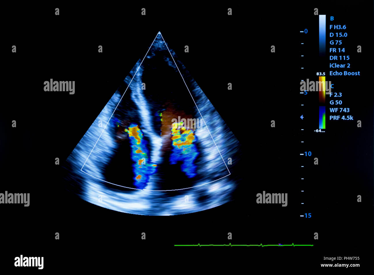 Colourful image of homan heart ultrasound monitor Stock Photo - Alamy