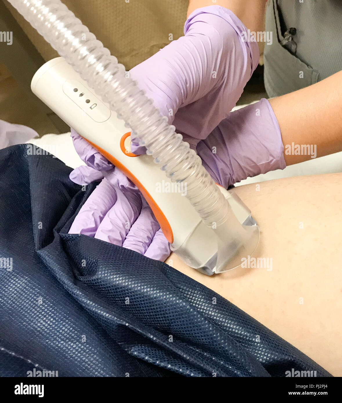 Medical shave with specialized electric razor and air suction to remove ...