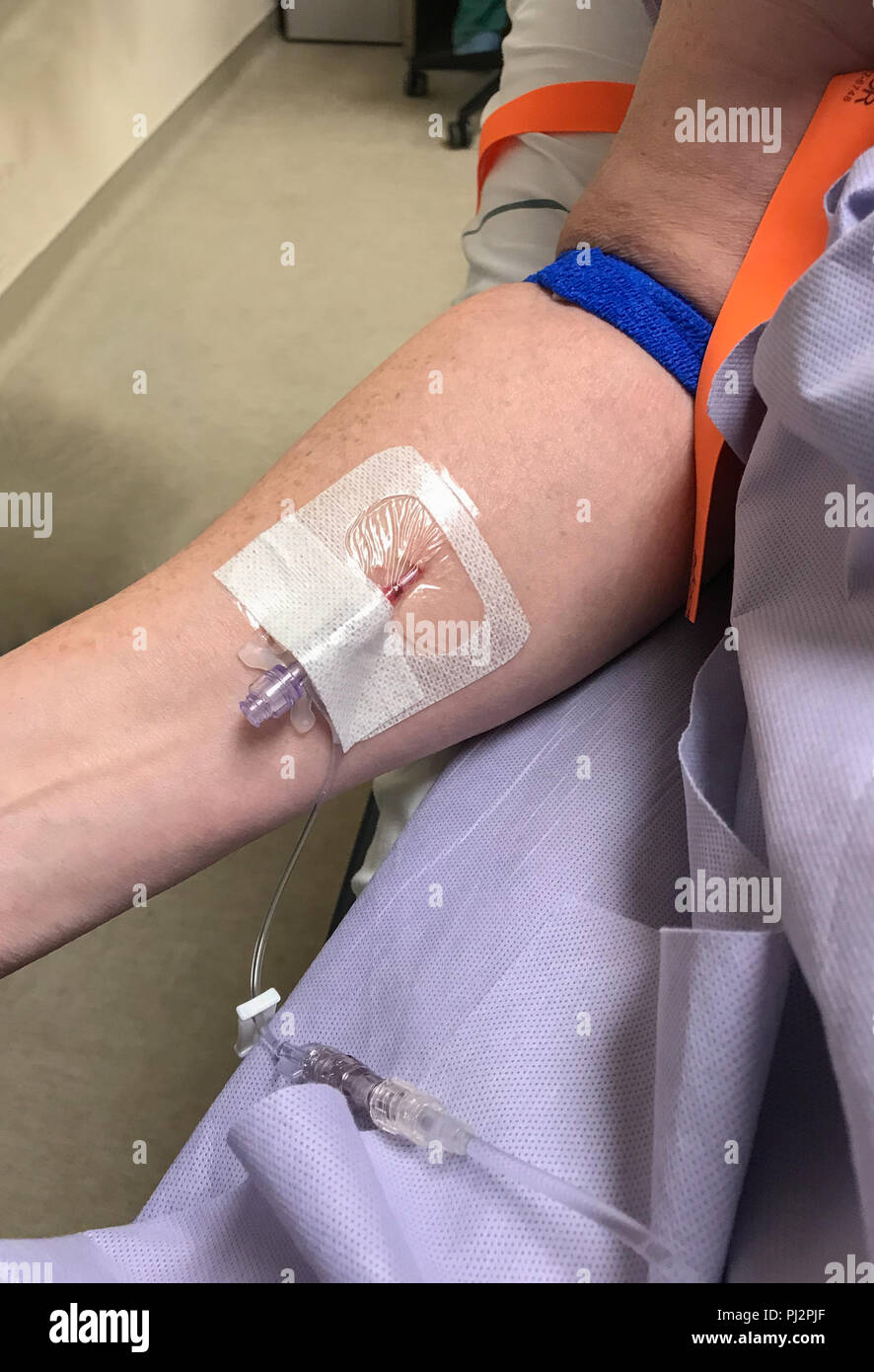 Iv therapy hi-res stock photography and images - Alamy