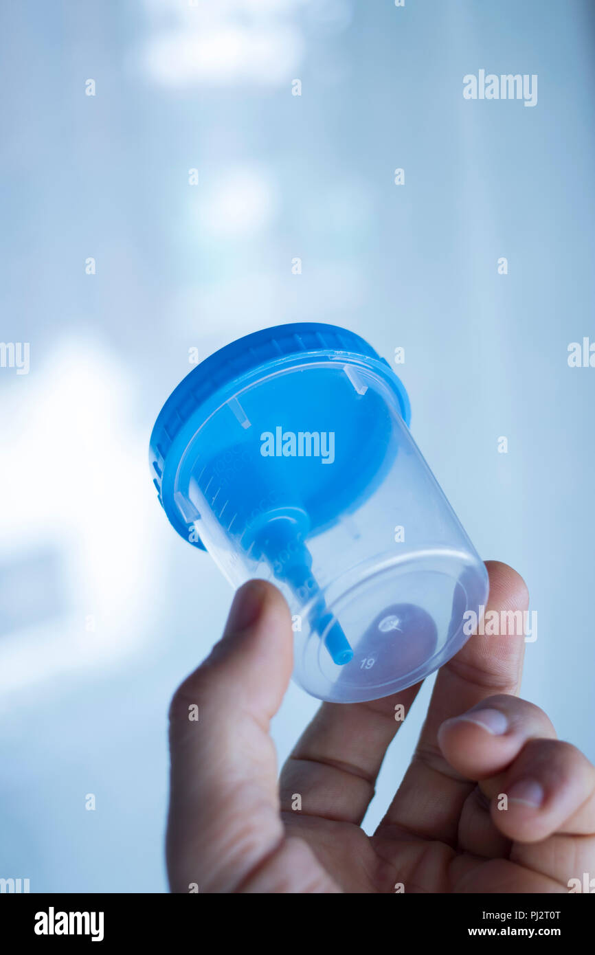 Medical urine test cup to hold patient dope testing anti drugs, sample ...