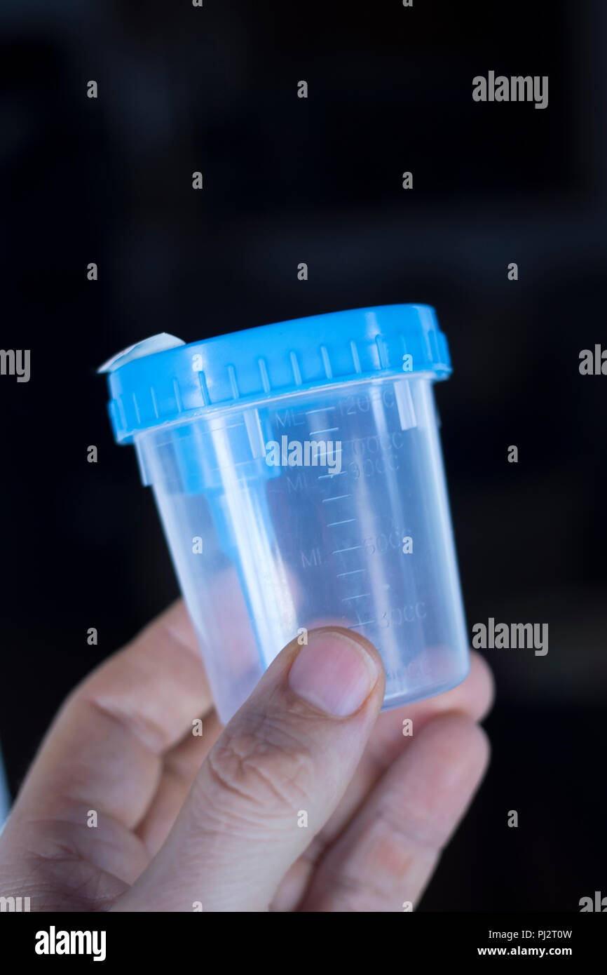 Medical urine test cup to hold patient dope testing anti drugs, sample ...
