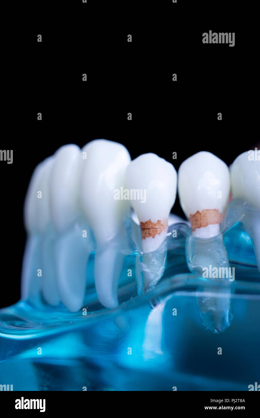 Dentist dental teeth teaching model showing each tooth and gum for ...