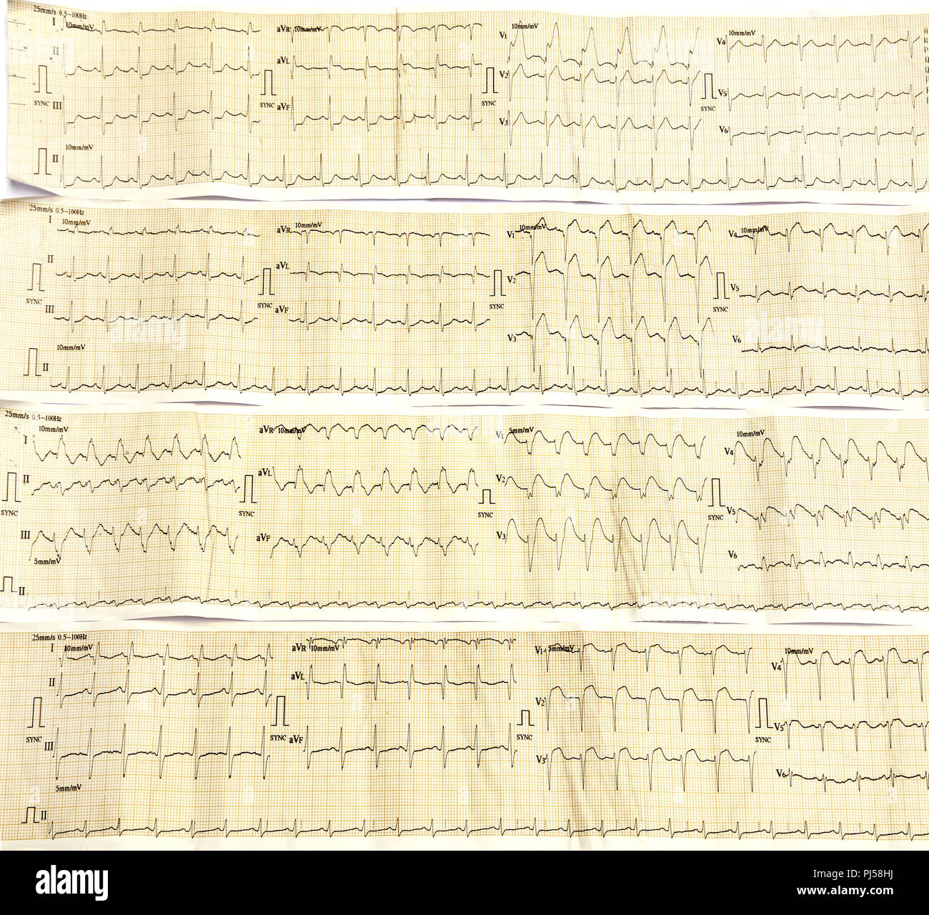 Electrocardiograph close up image as a background Stock Photo - Alamy