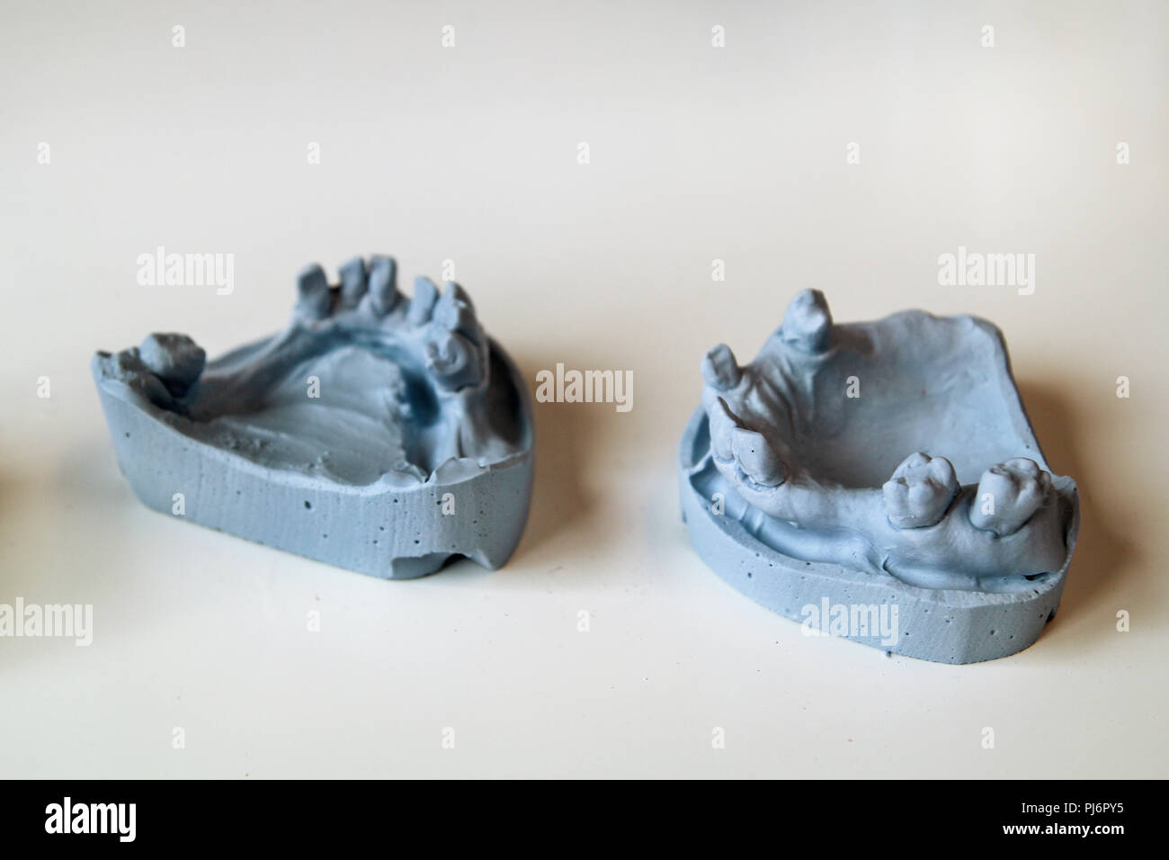 Plaster model of the jaws. Dentures and dentistry. Dental prosthesis ...