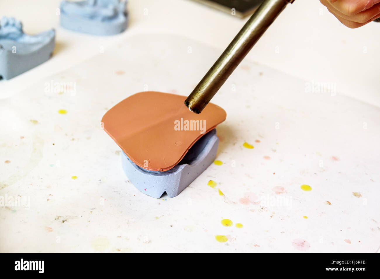 Warming of Shellac base plates. Dentures. Dental prosthesis, dentures ...