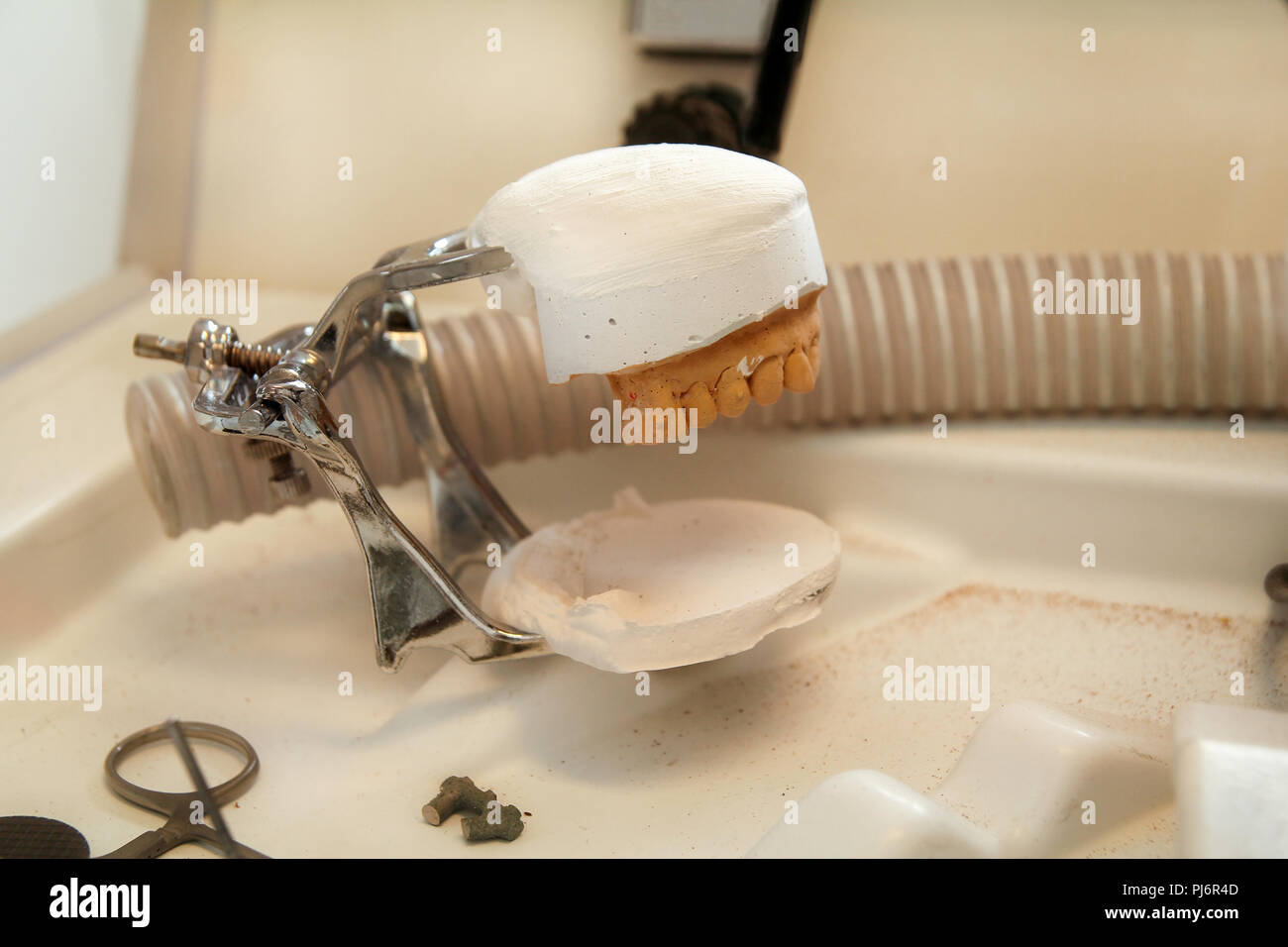 The plaster model of the jaws in articulator. Dental prosthesis ...