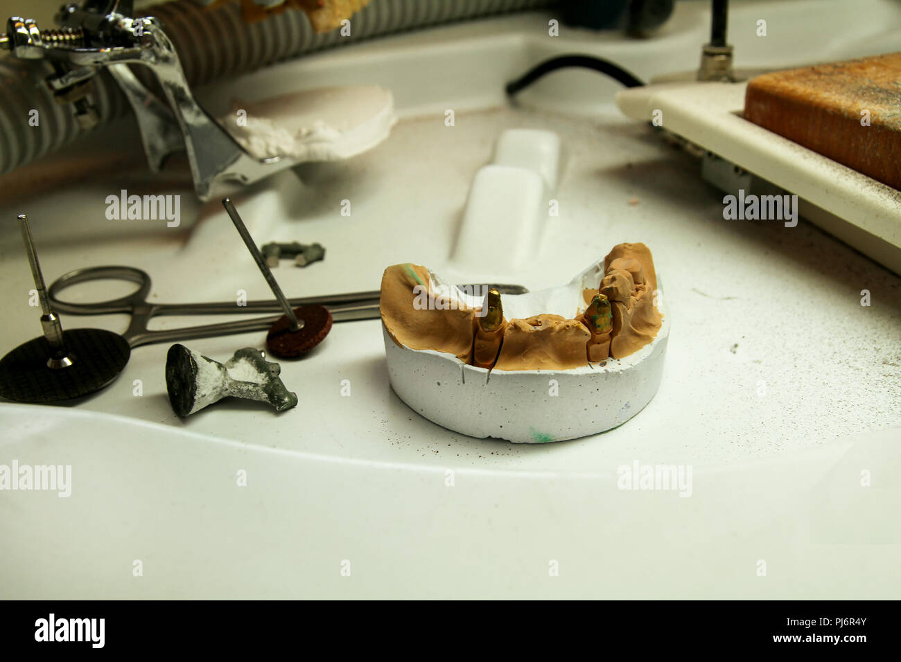 The plaster model of the jaws with tools. Dental prosthesis, dentures ...