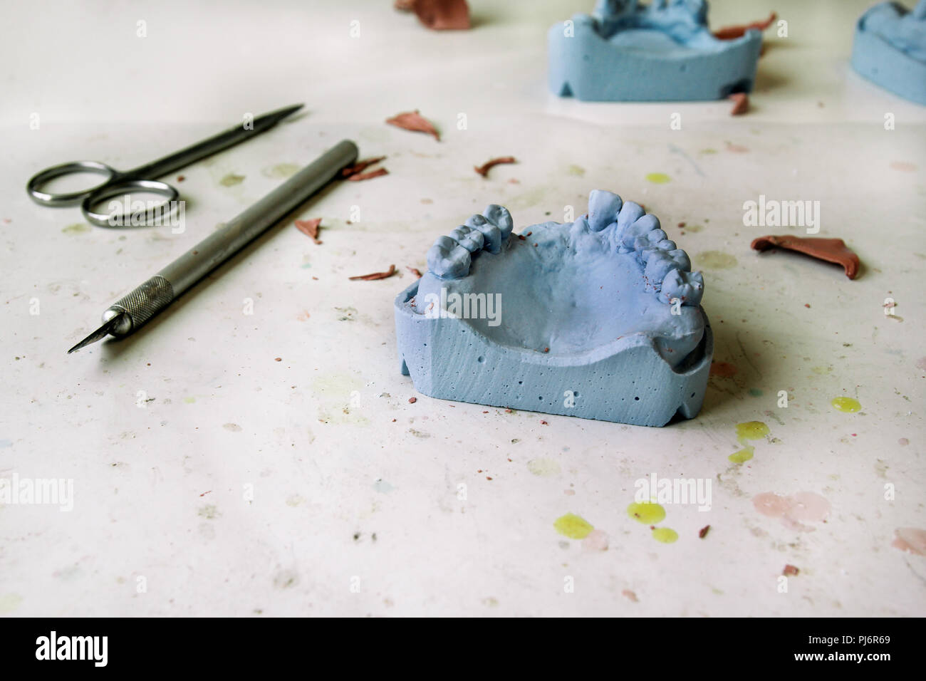 The plaster model of the jaws. Dental prosthesis, dentures, prosthetics ...