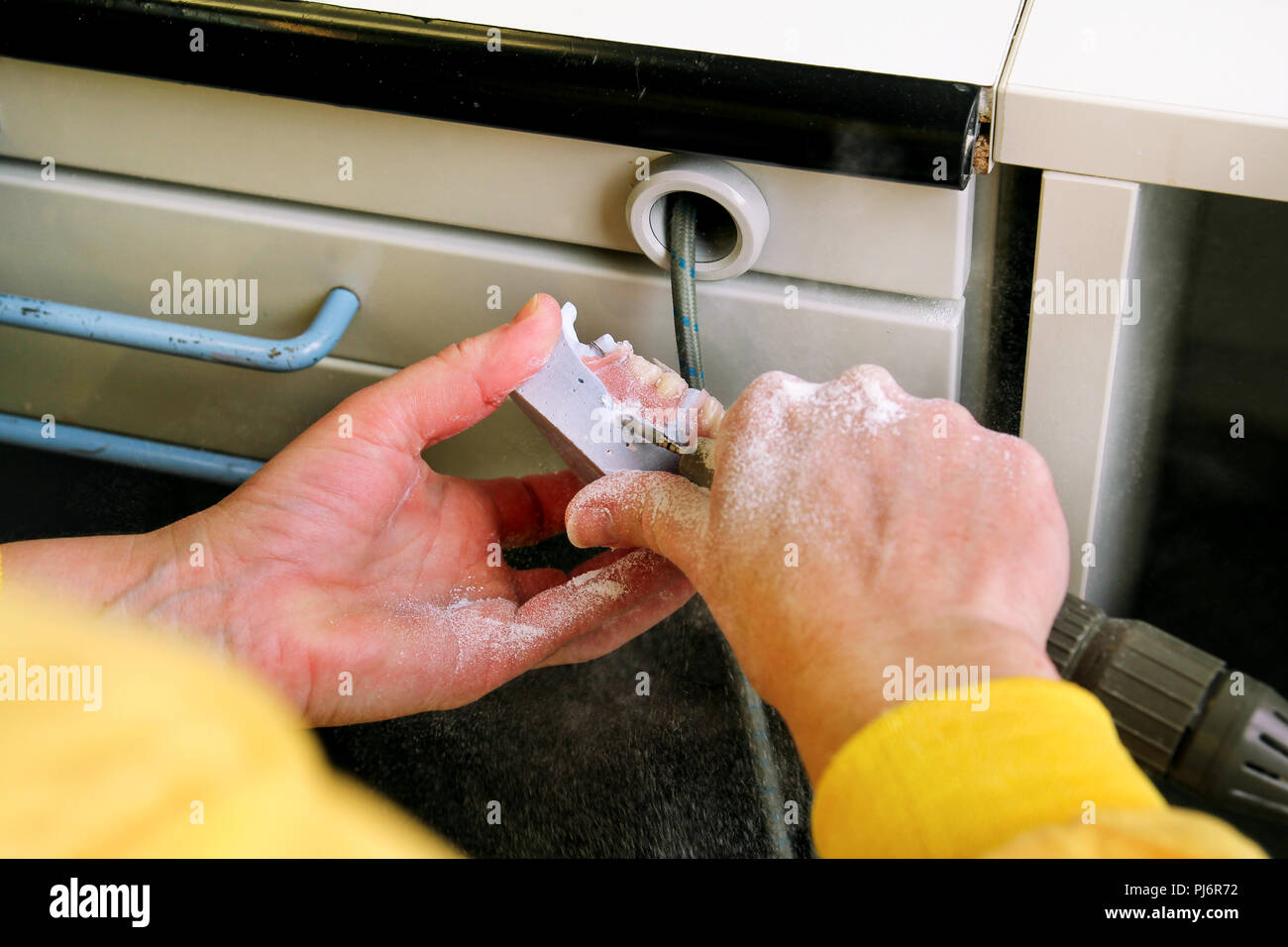 Detaching a dental prosthesis form a plaster model. Dental prosthesis ...