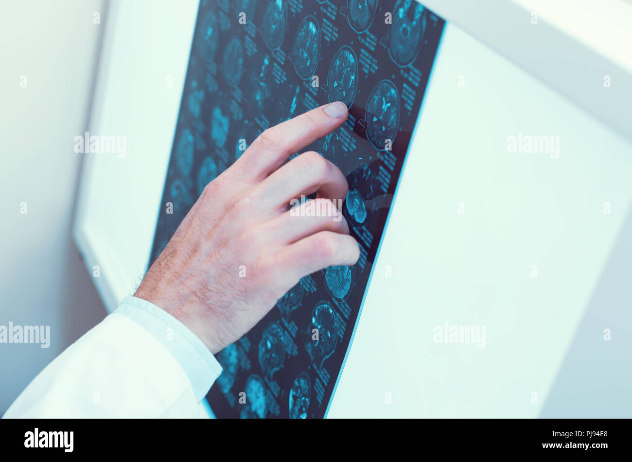 Hand ct scan High Resolution Stock Photography and Images - Alamy