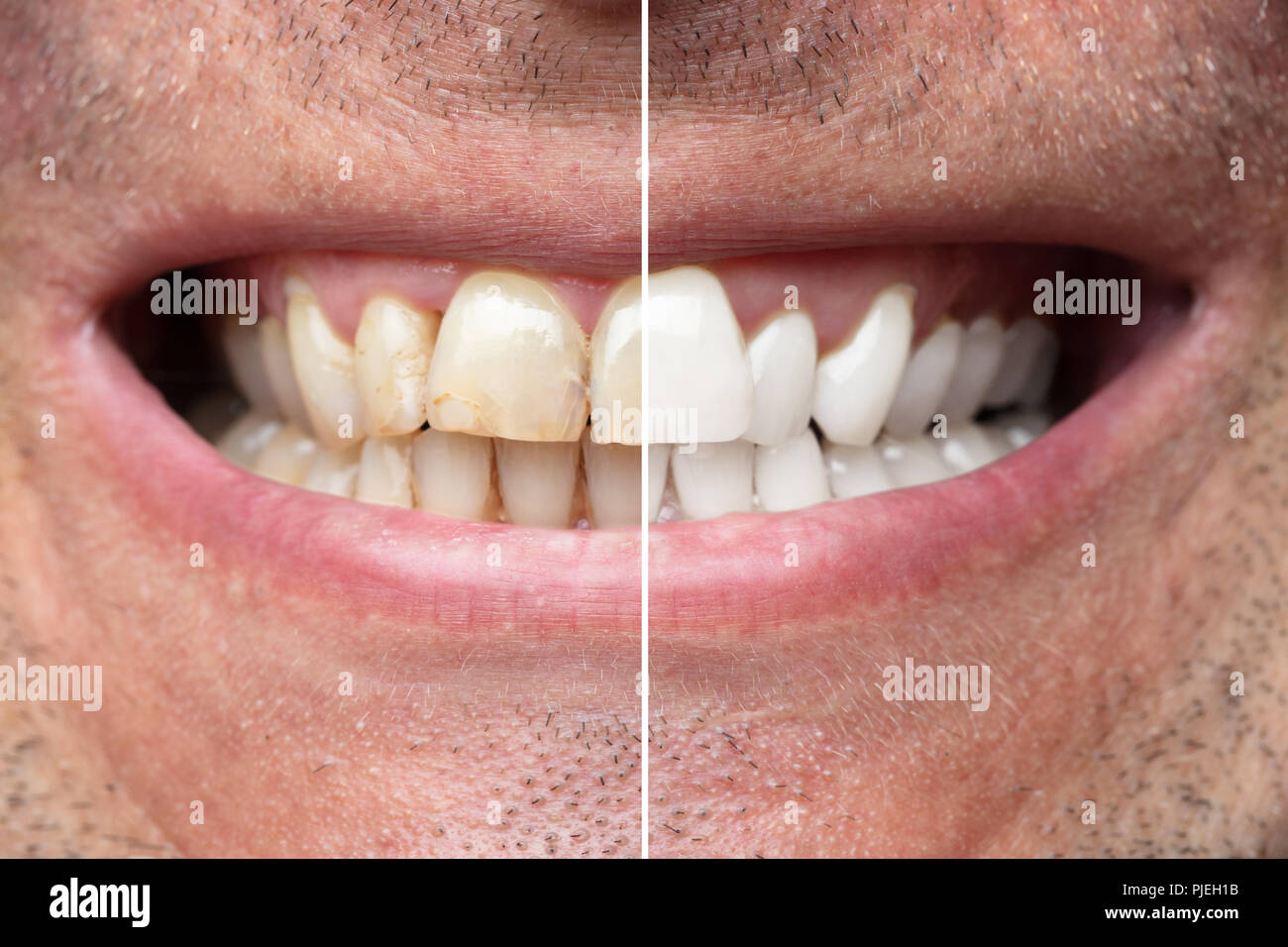 Before and after man hi-res stock photography and images - Alamy