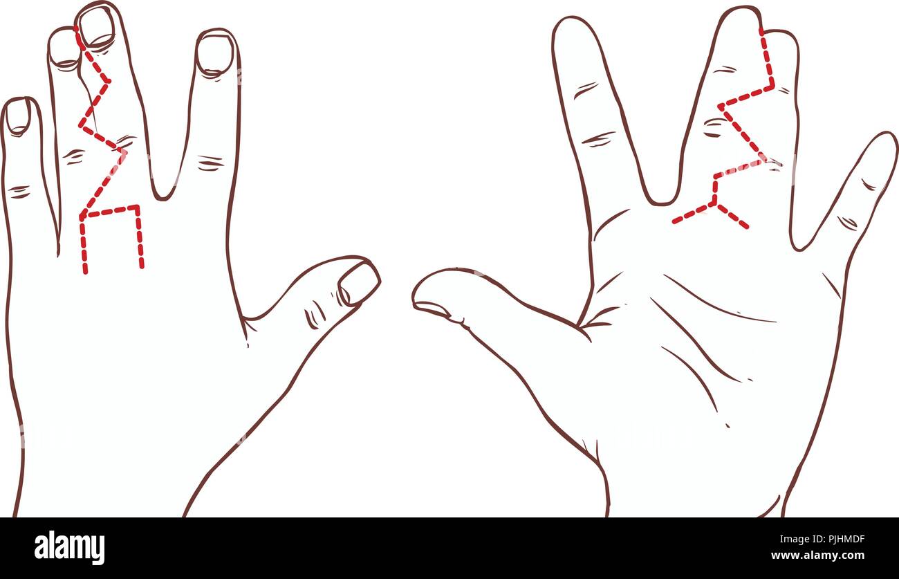 Transverse Stock Vector Images - Alamy