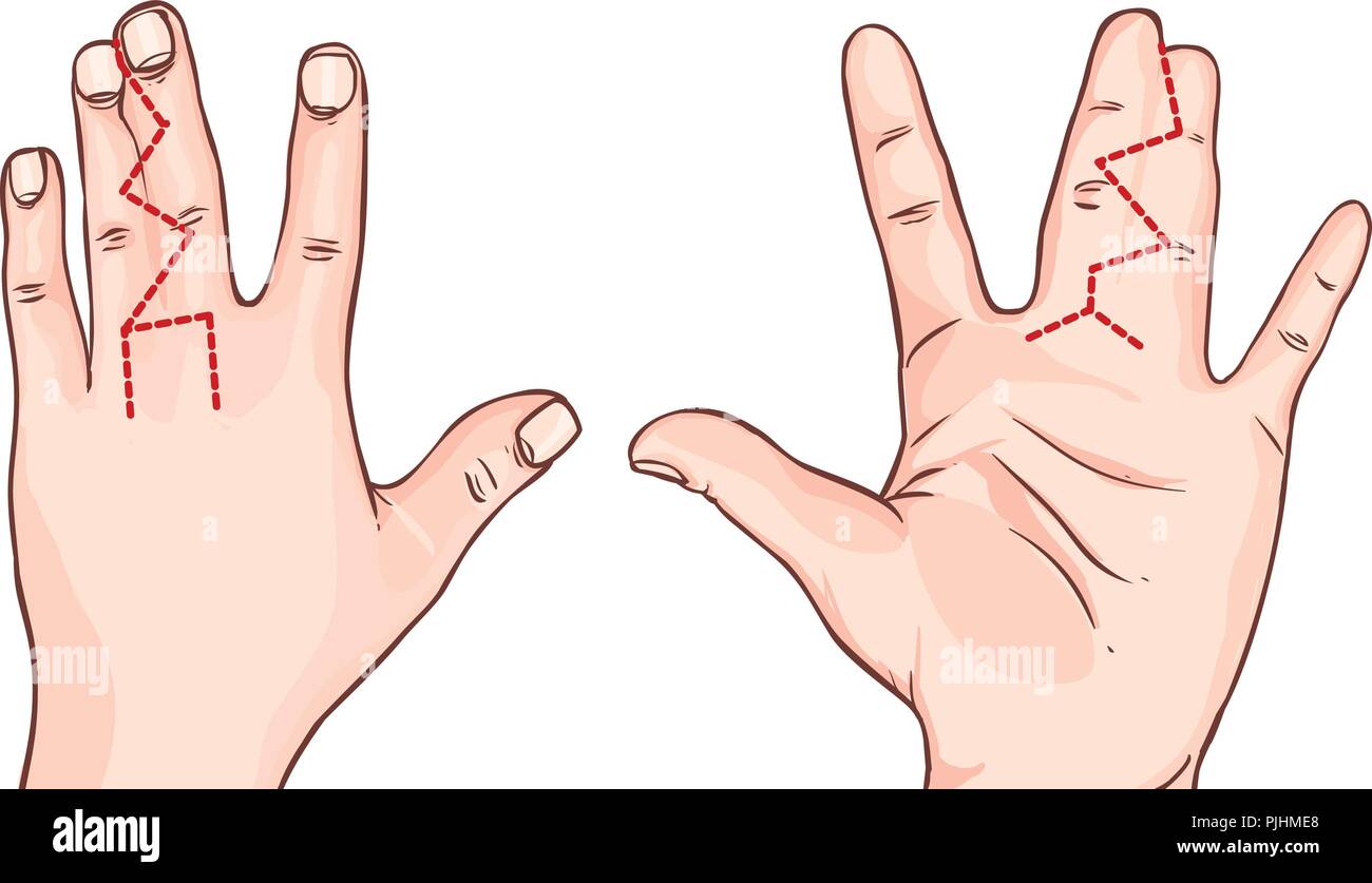 Transverse Stock Vector Images - Alamy