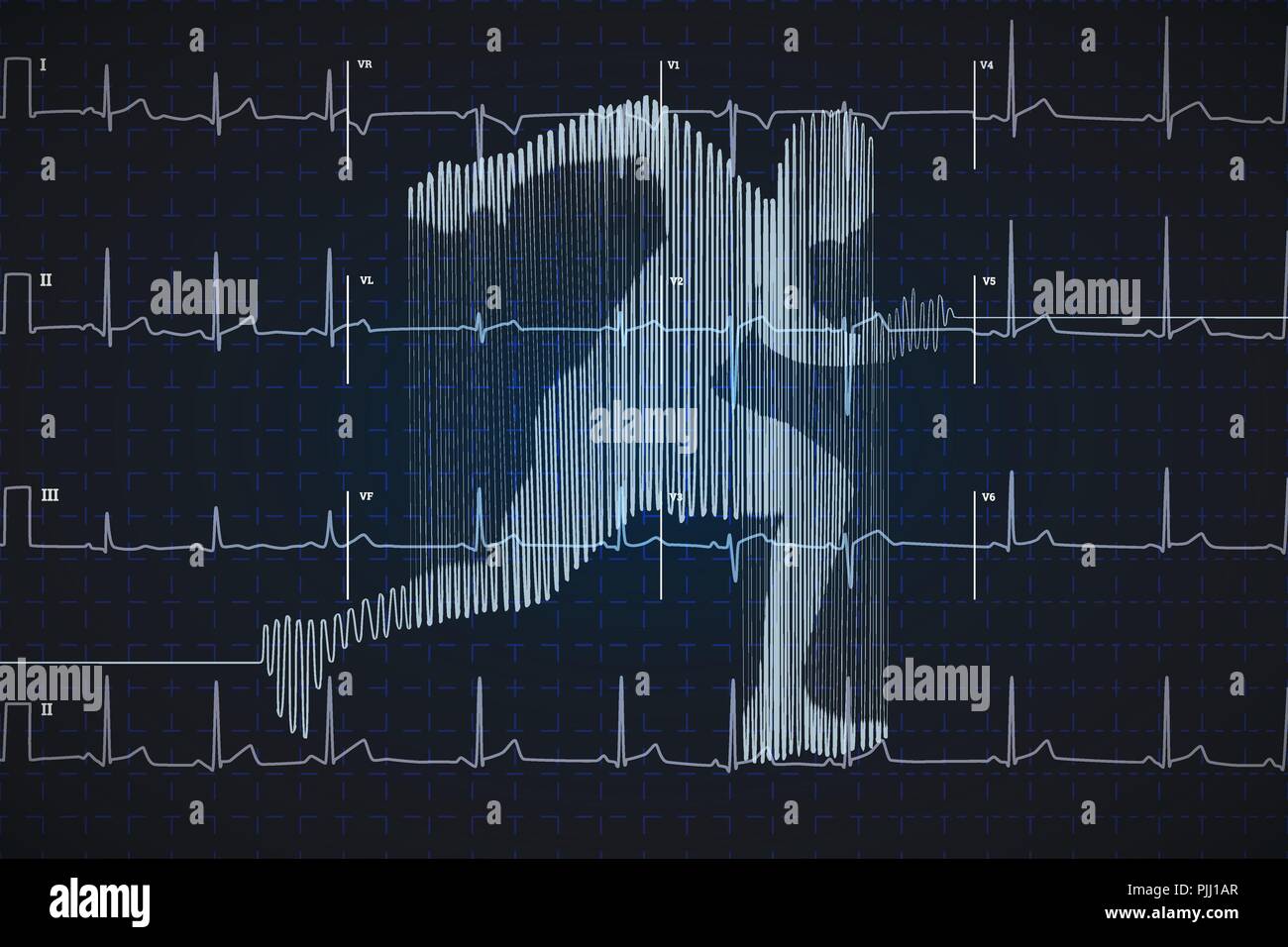 Fake news on digital screen Stock Vector Images - Alamy