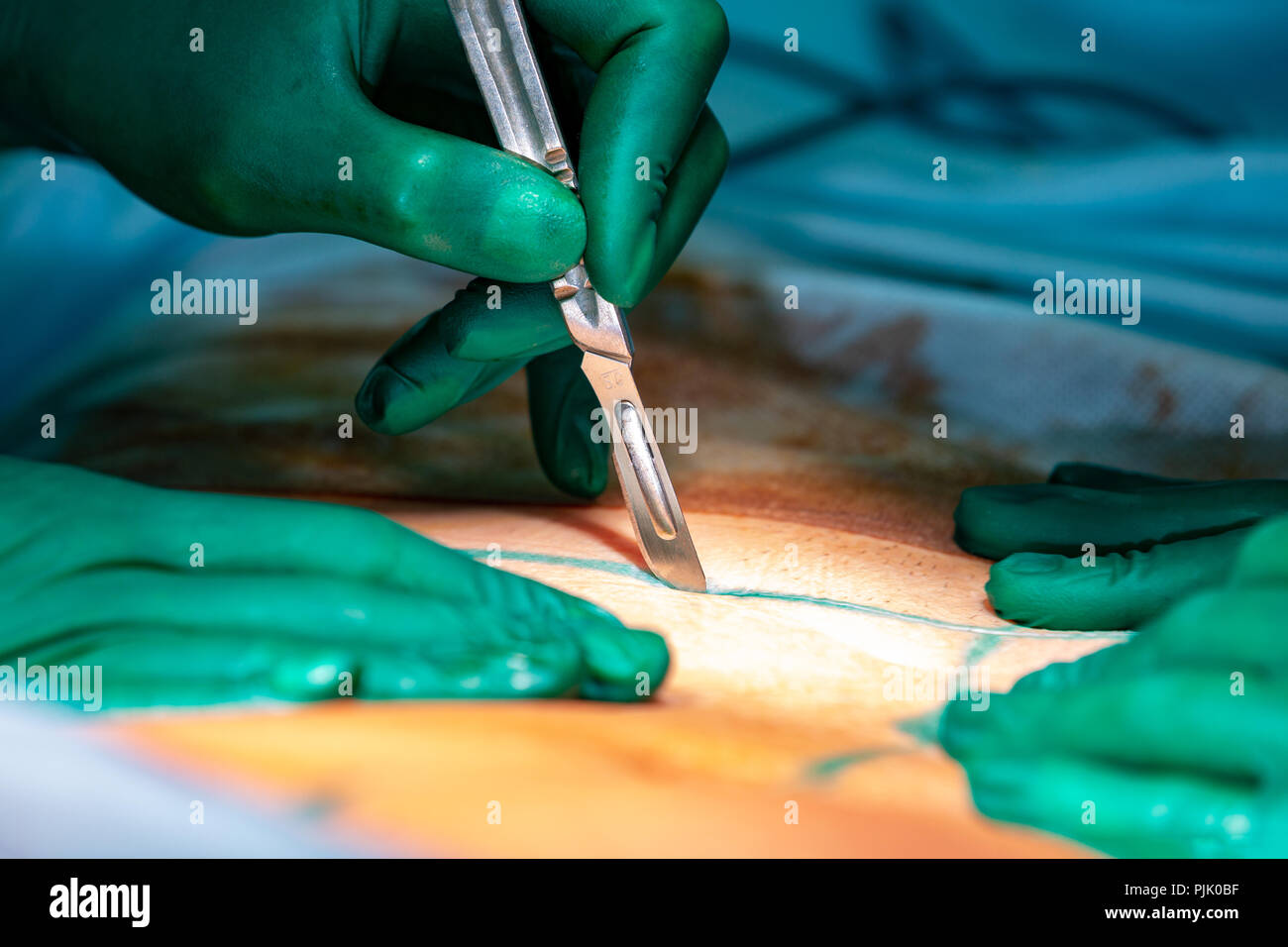 Abdomen Operation High Resolution Stock Photography and Images - Alamy