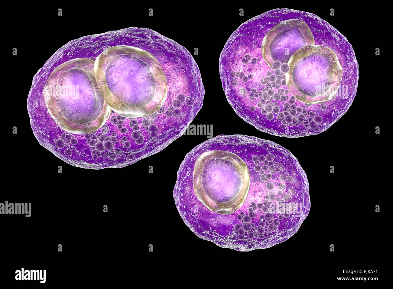 Cytomegalovirus infection. Computer illustration of human cells showing ...