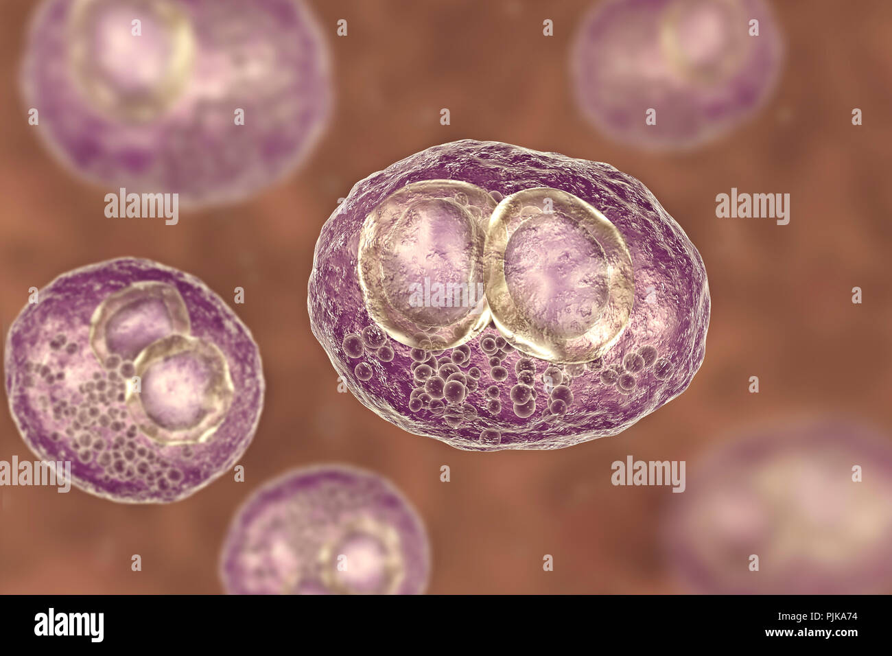 Cytomegalovirus infection. Computer illustration of human cells showing ...