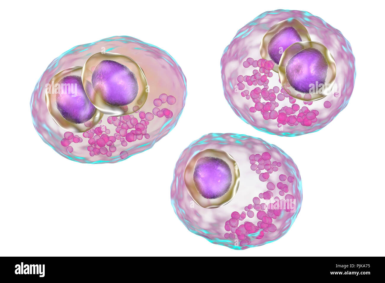 Cytomegalovirus infection. Computer illustration of human cells showing ...