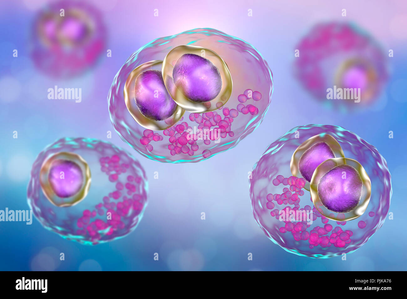 Cytomegalovirus infection. Computer illustration of human cells showing ...