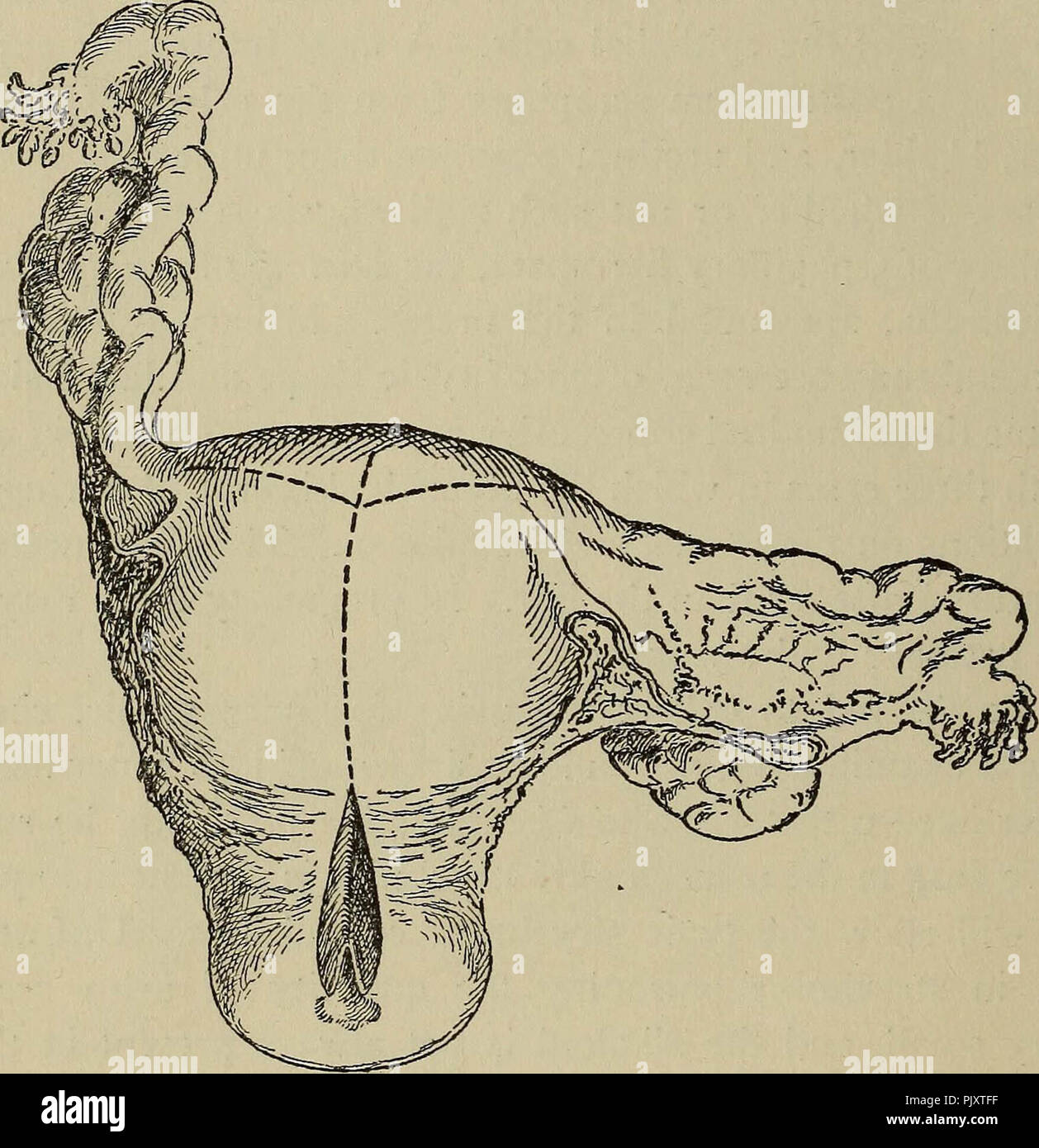 "Postmortem pathology; a manual of the technic of post-mortem ...