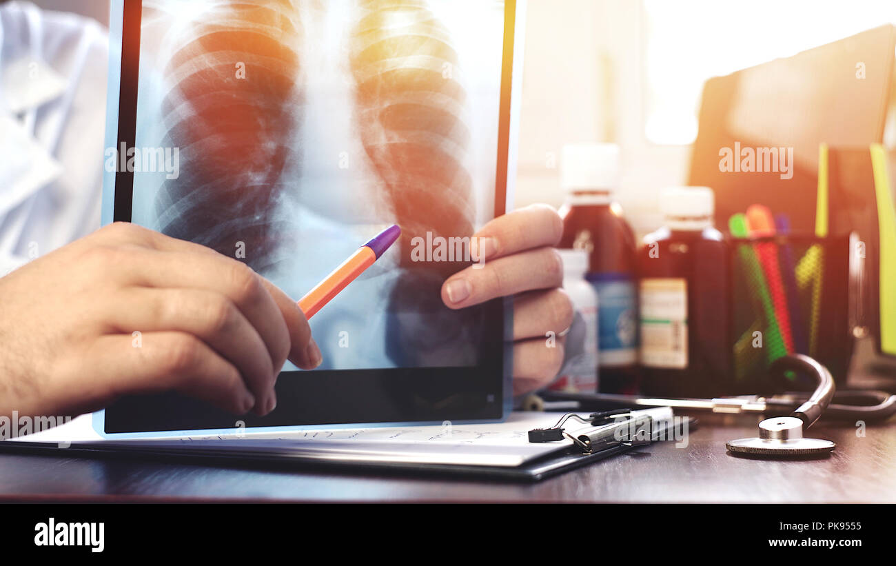 Doctor explaining x-ray image of a chest to a patient Stock Photo - Alamy