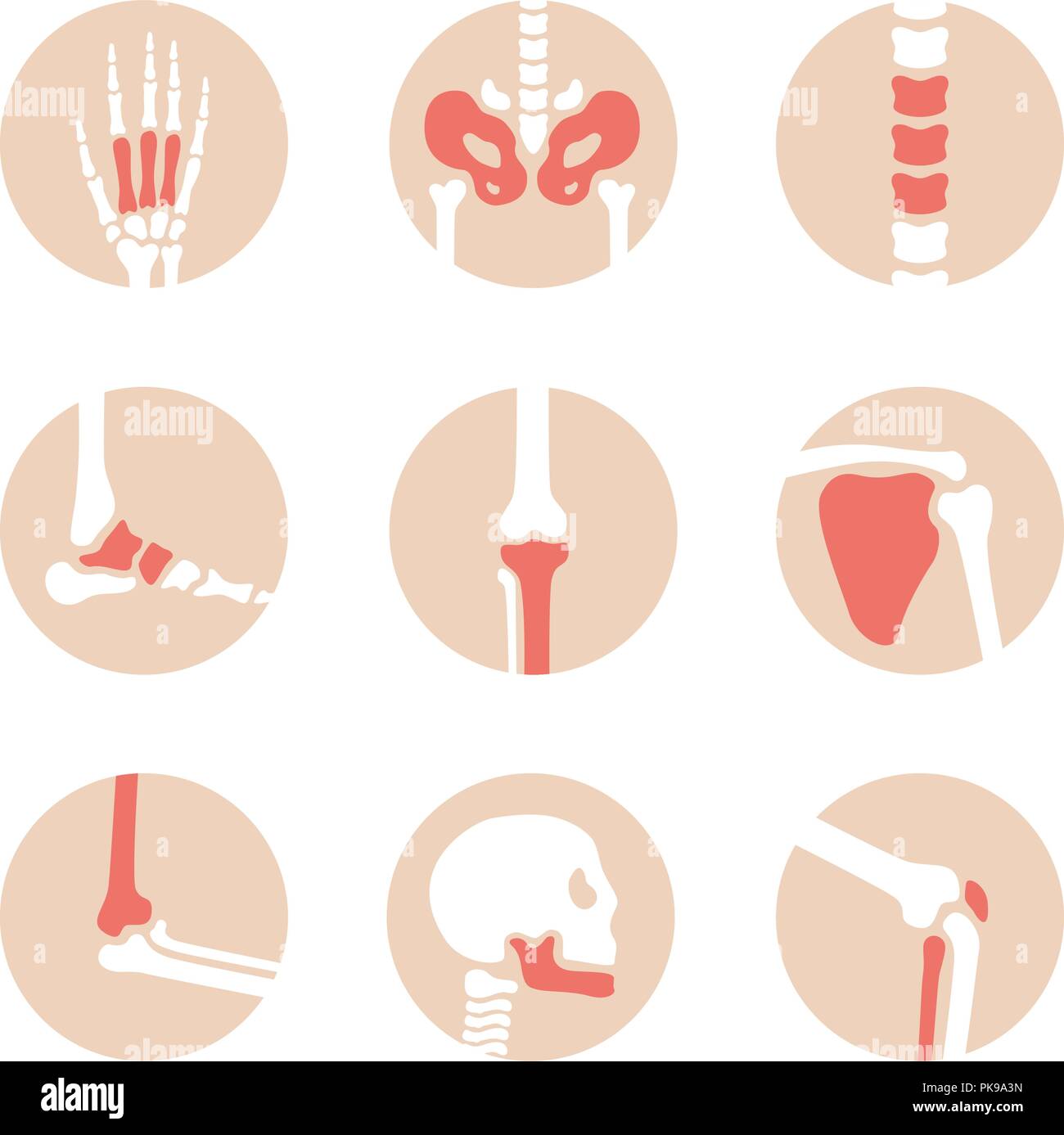 Vector set of human joints with red damaged parts. Disease in bone ...