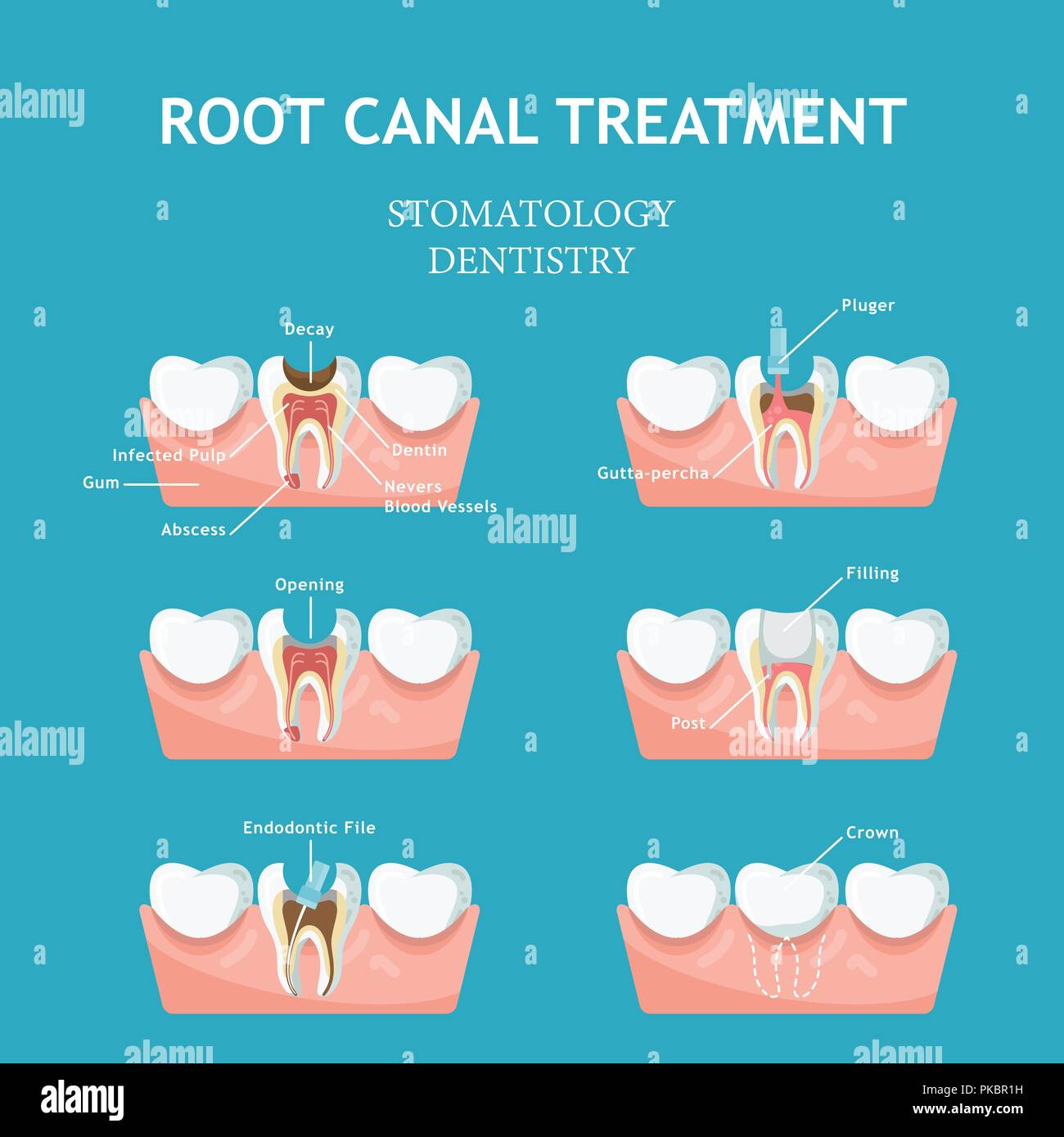 Root Cavity Stock Vector Images - Alamy