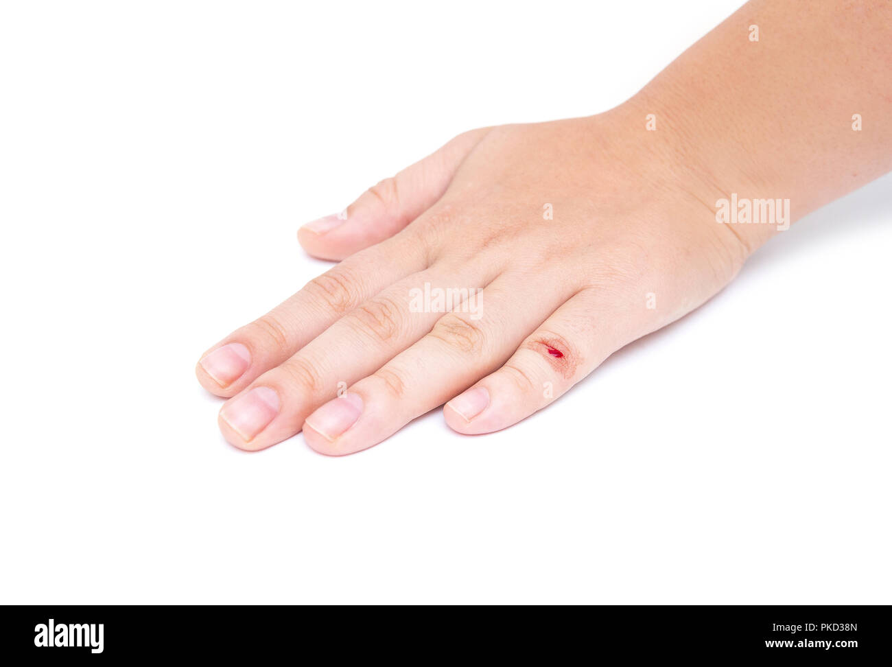 With one wounded finger hi-res stock photography and images - Alamy
