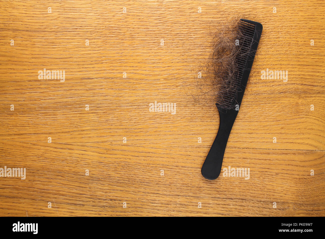 Hairloss women hi-res stock photography and images - Alamy