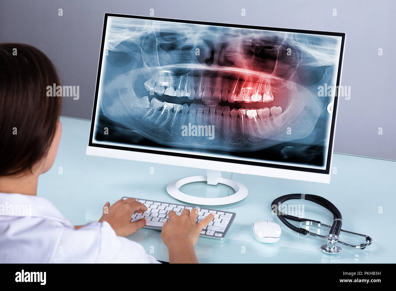 Female Doctor Looking At Teeth X-ray On Computer Over Desk In Clinic ...