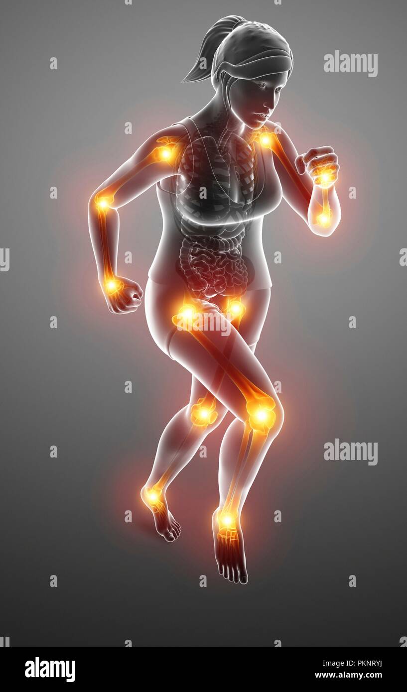 Woman with joint pain, computer illustration Stock Photo - Alamy