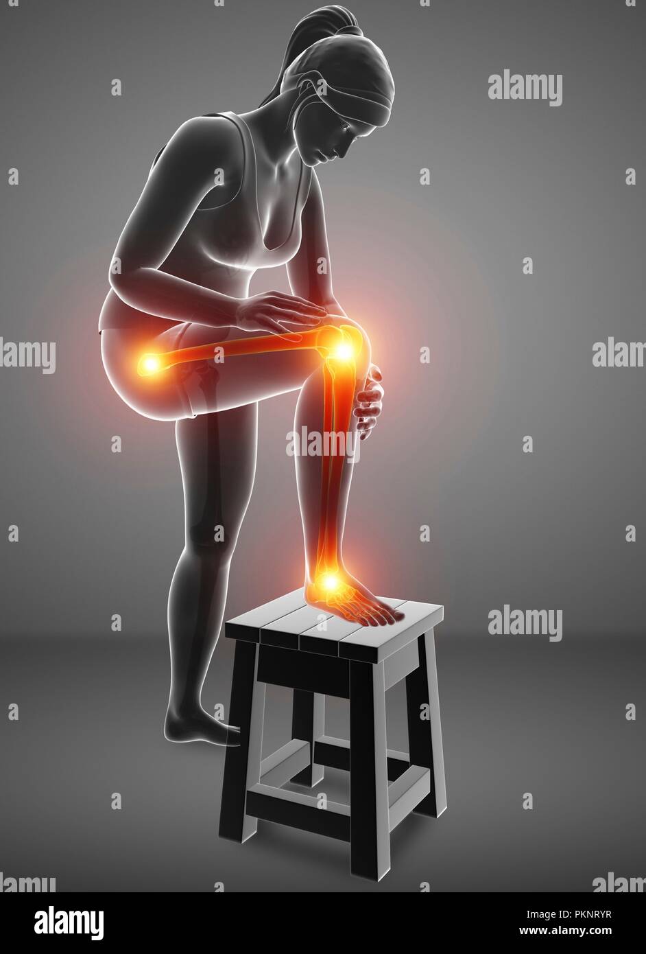 Woman with leg pain, computer illustration Stock Photo - Alamy