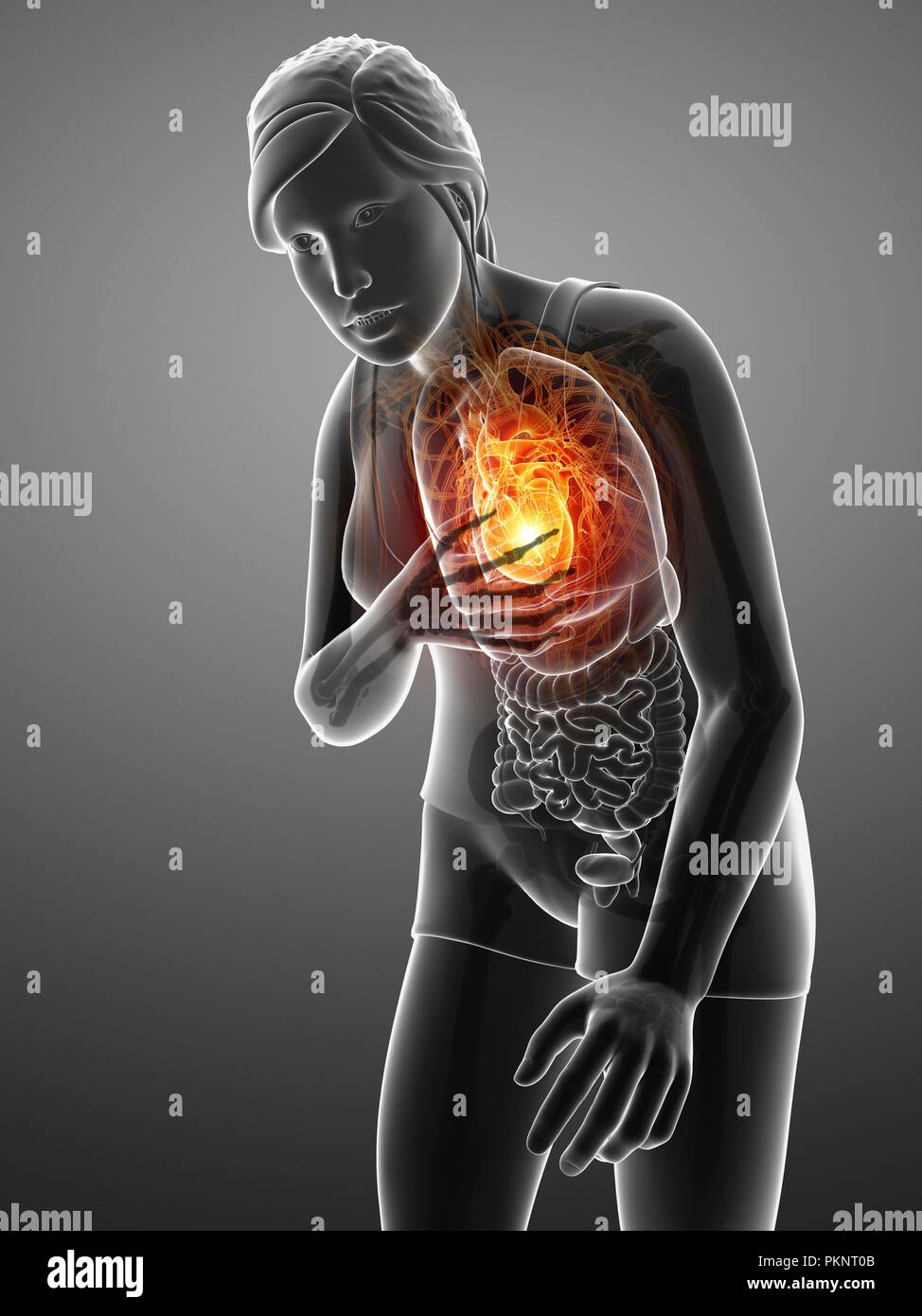 Woman with chest pain, computer illustration Stock Photo - Alamy