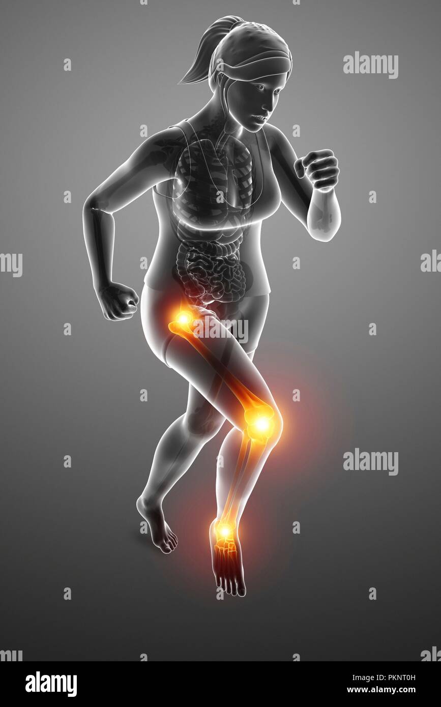 Woman with leg pain, computer illustration Stock Photo - Alamy