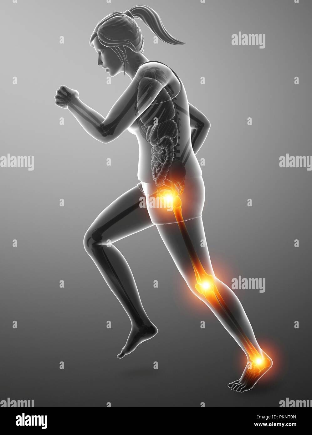Woman with leg pain, computer illustration Stock Photo - Alamy
