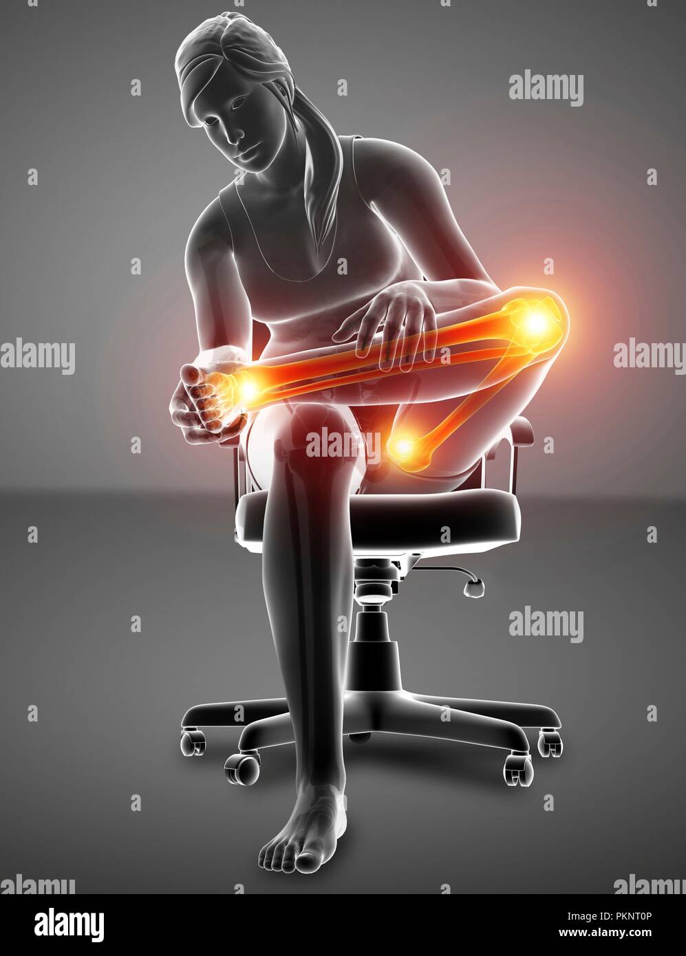 Woman with leg pain, computer illustration Stock Photo - Alamy