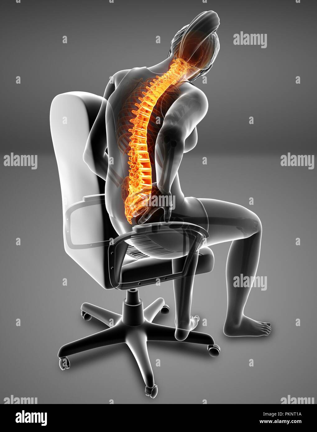Woman with back pain, computer illustration Stock Photo - Alamy