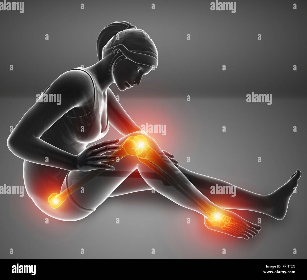 Woman with leg pain, computer illustration Stock Photo - Alamy