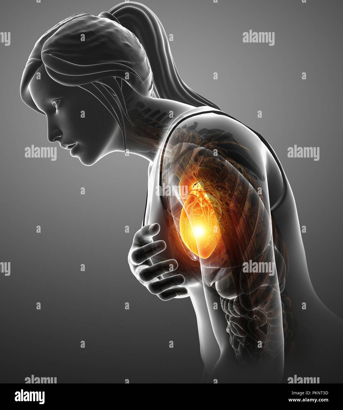 Woman with chest pain, computer illustration Stock Photo - Alamy