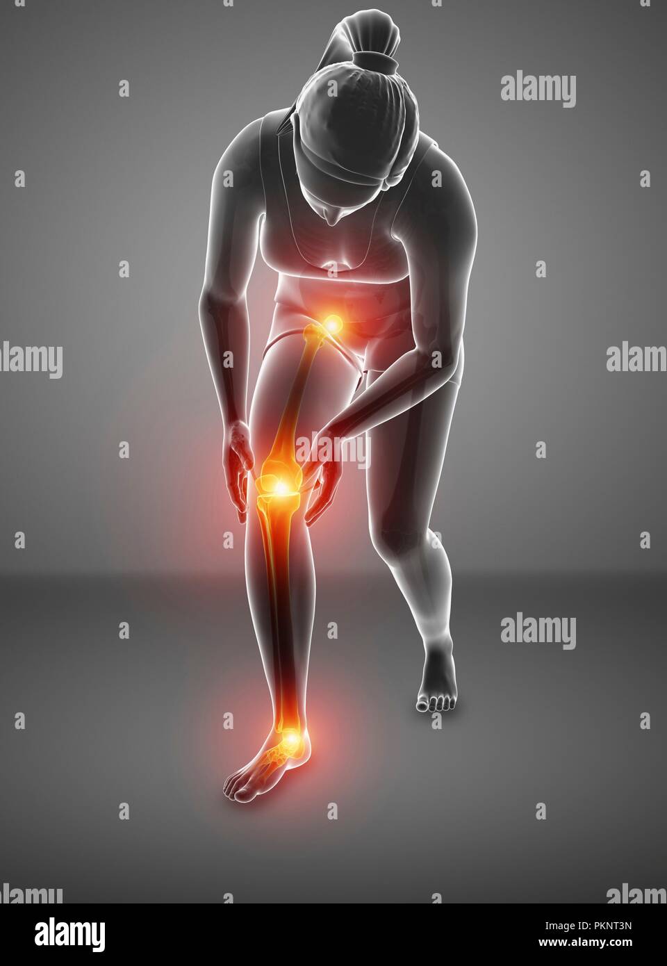 Woman with leg pain, computer illustration Stock Photo - Alamy