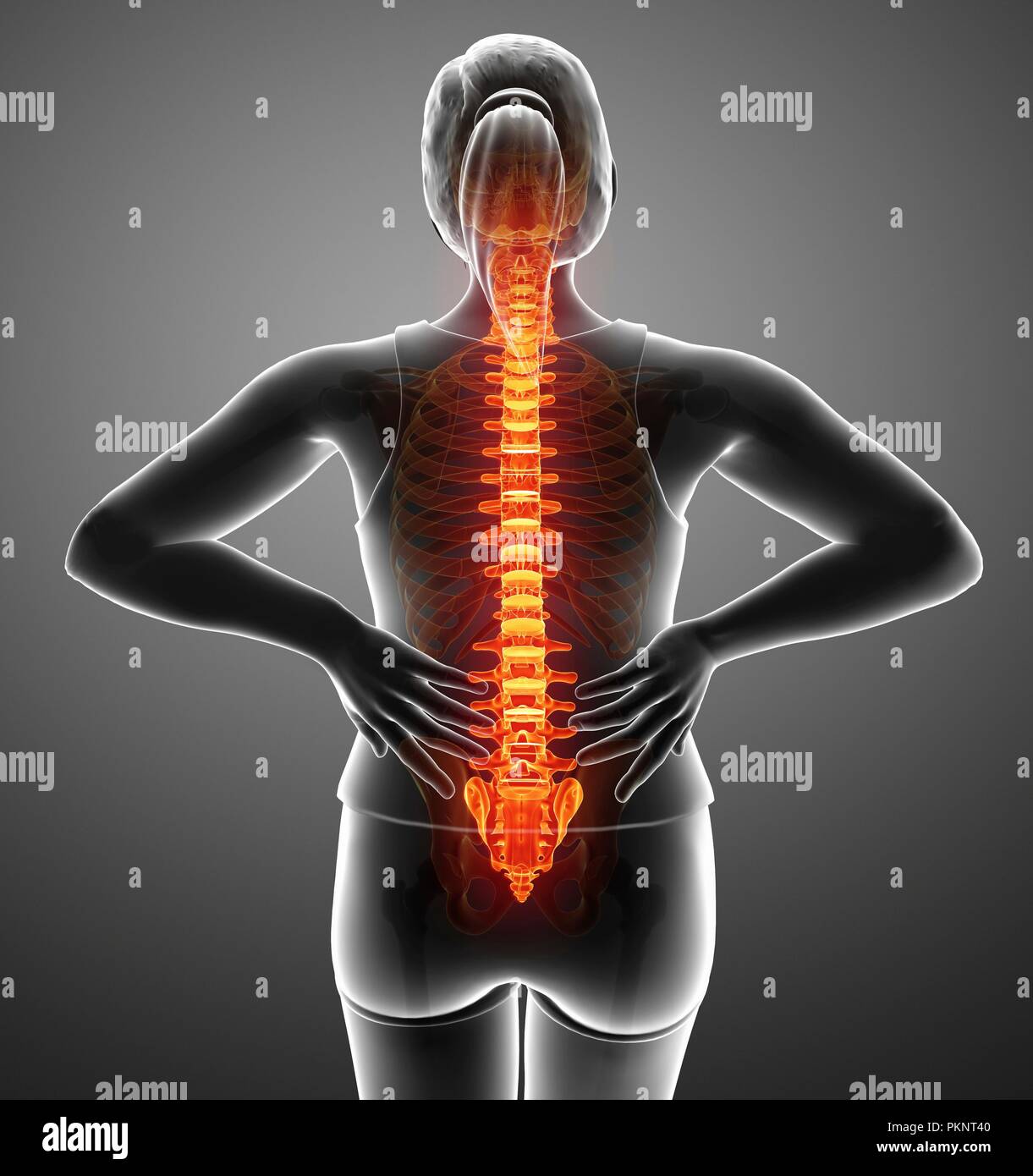 Woman with back pain, computer illustration Stock Photo - Alamy