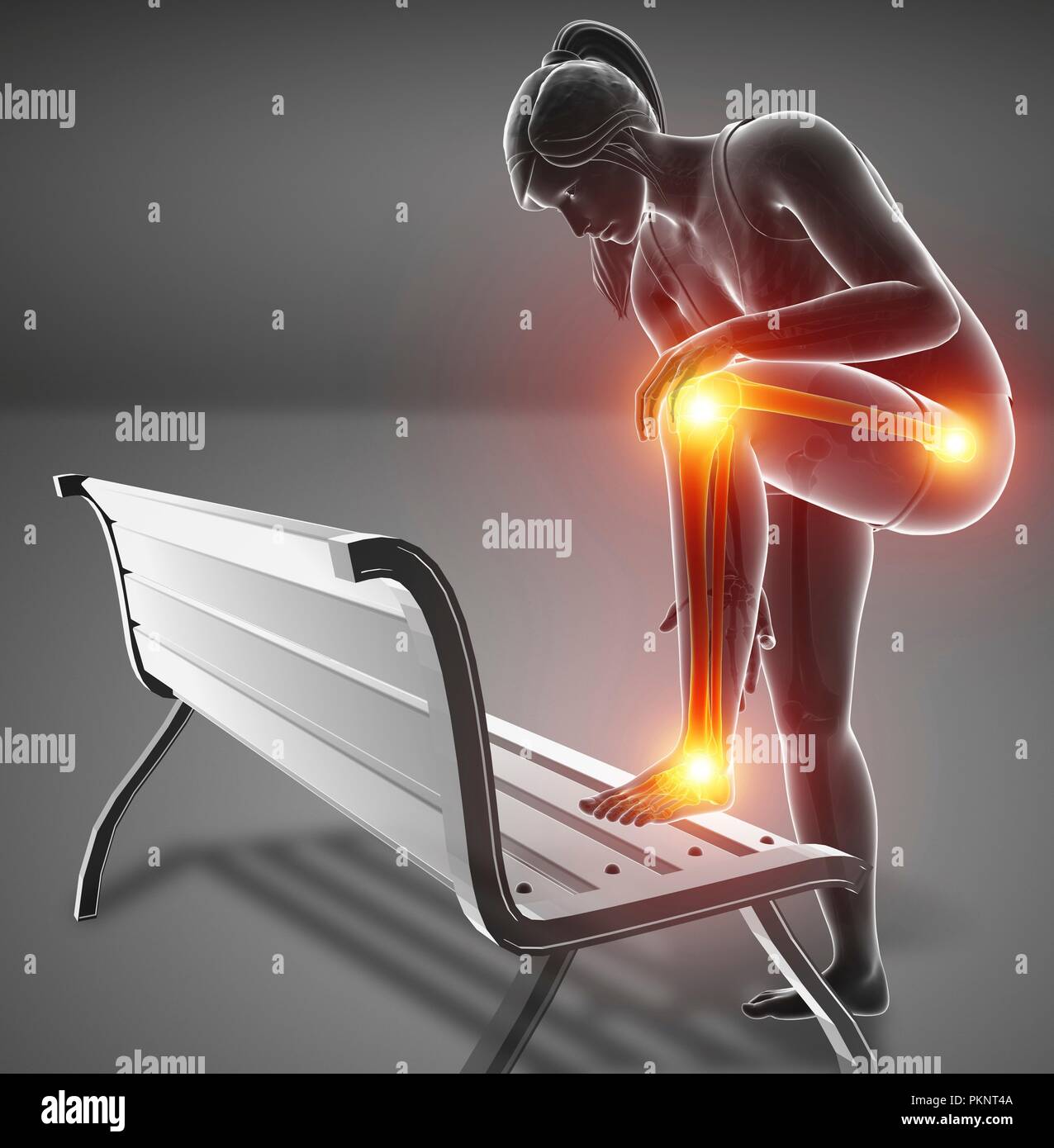 Woman sore legs illustration hi-res stock photography and images - Alamy