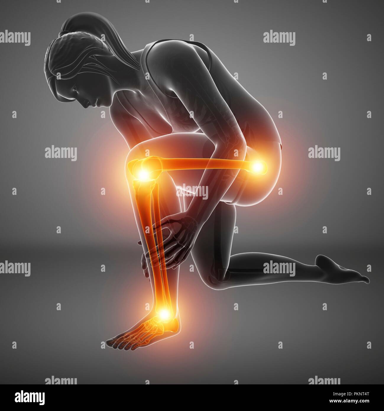 Woman with leg pain, computer illustration Stock Photo - Alamy
