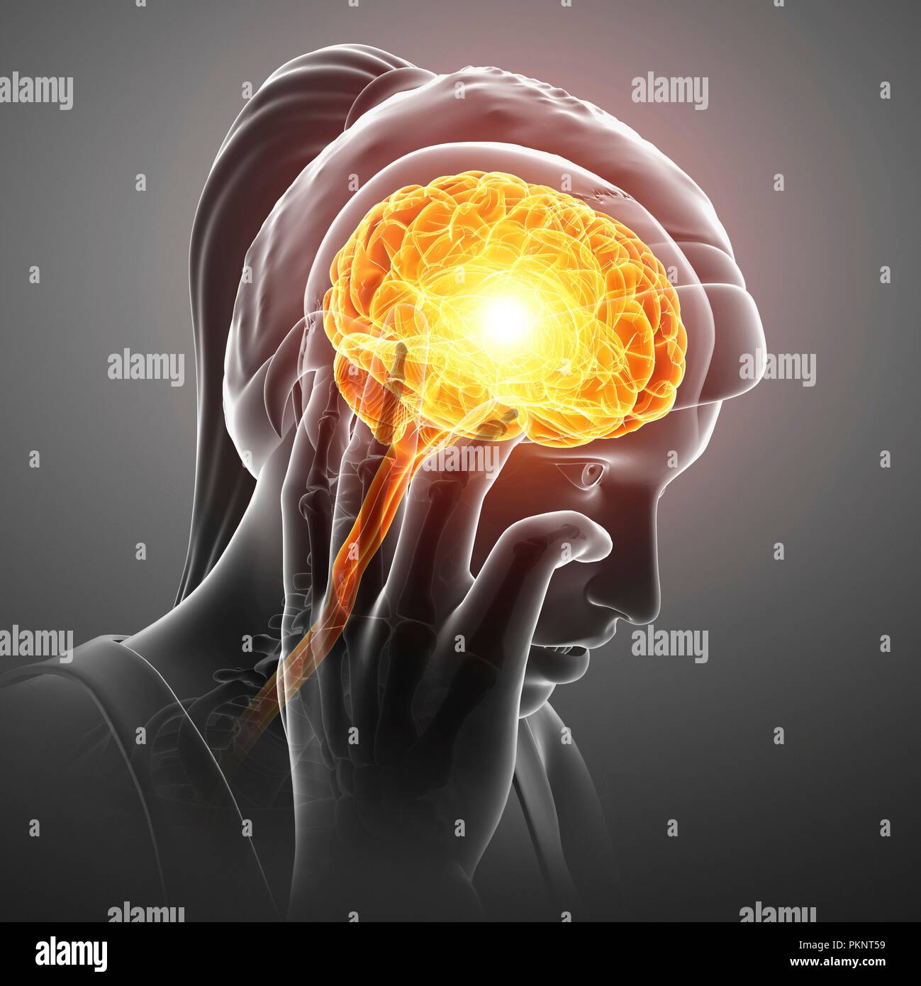 Woman with headache, computer illustration Stock Photo - Alamy